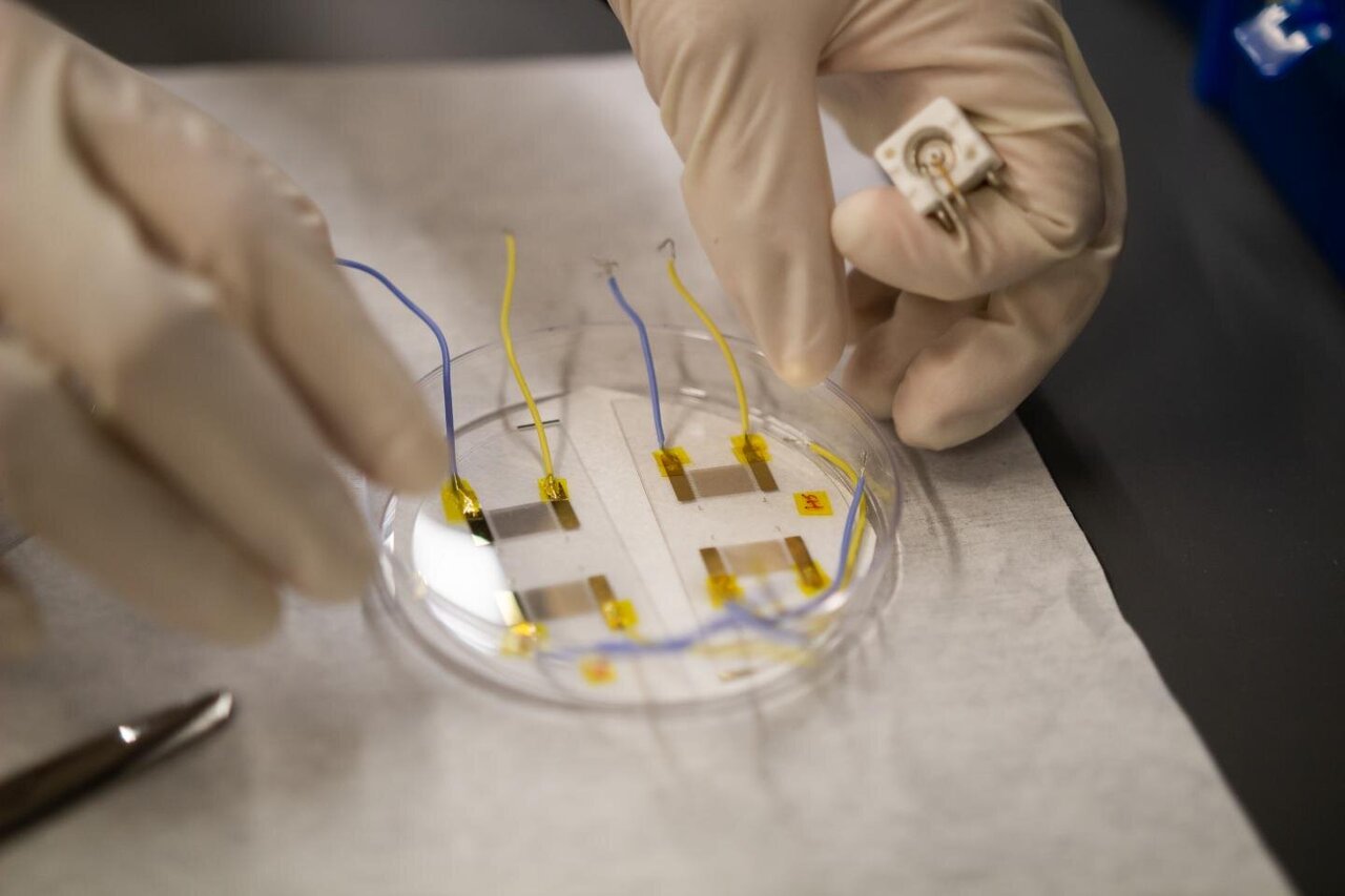 The Role of Technology in Sickle Cell Organizations